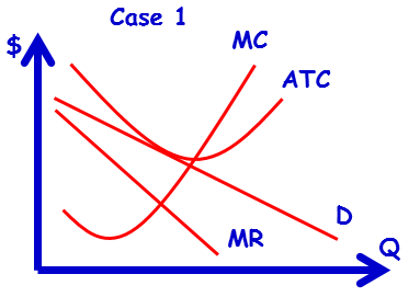 The graphs above shows the cost curves, the | StudyX