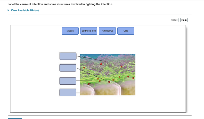 Label the cause of infection and some