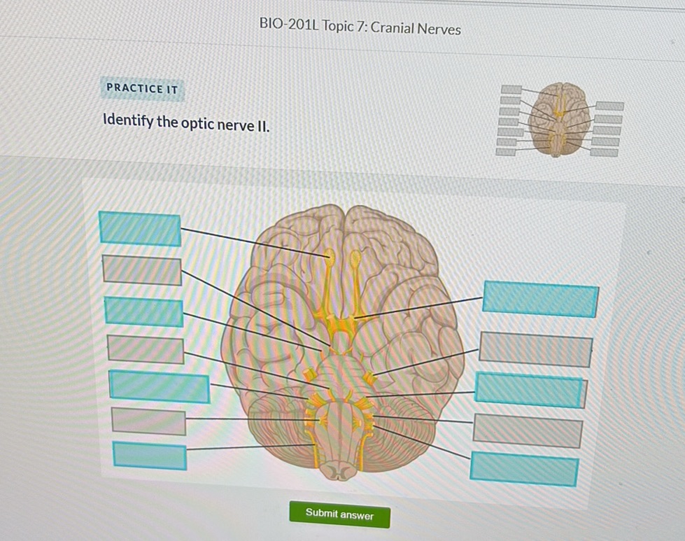 Identify the optic nerve II