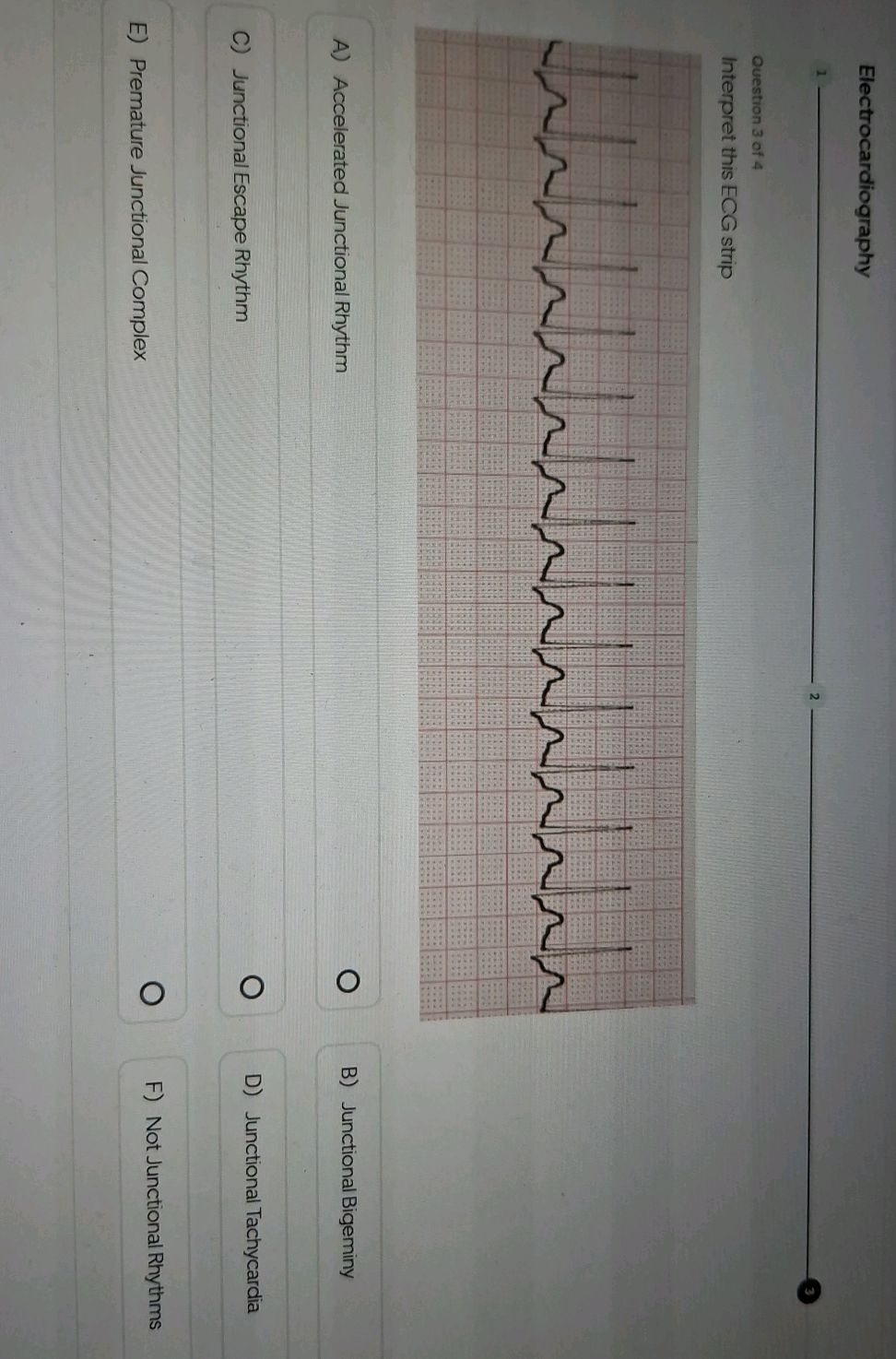 Interpret this ECG strip A) Accelerated