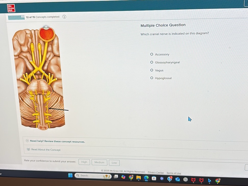 Multiple Choice Question Which cranial nerve | StudyX