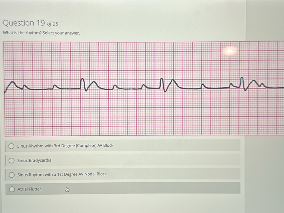 Question 19 of 25 What is the rhythm? Select | StudyX