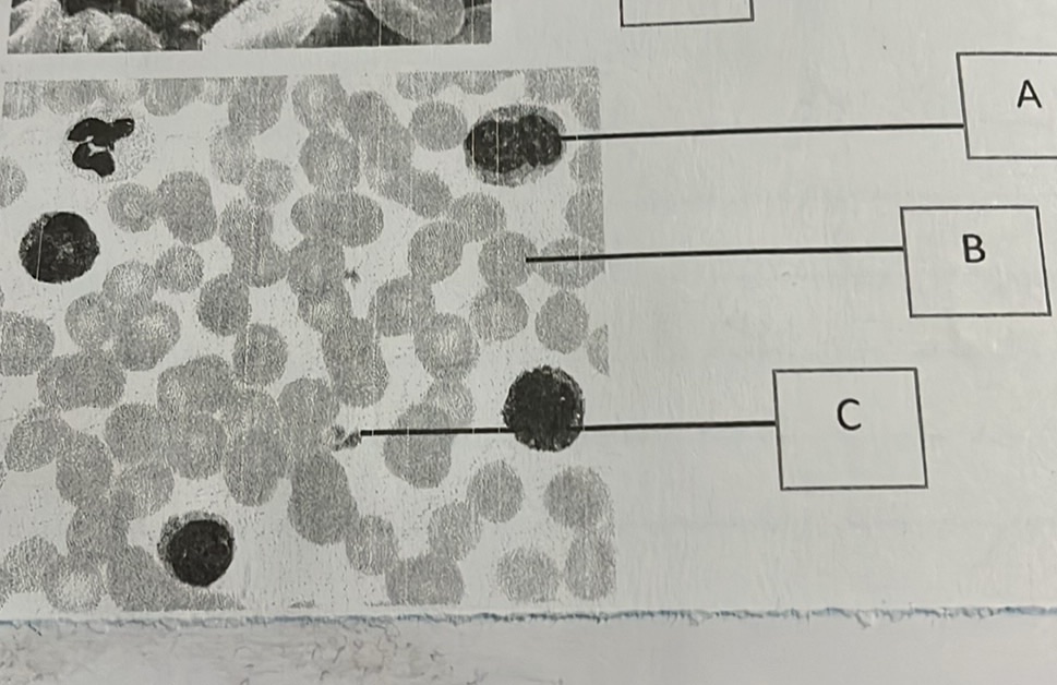 Identify the blood cells labeled A, B, and C