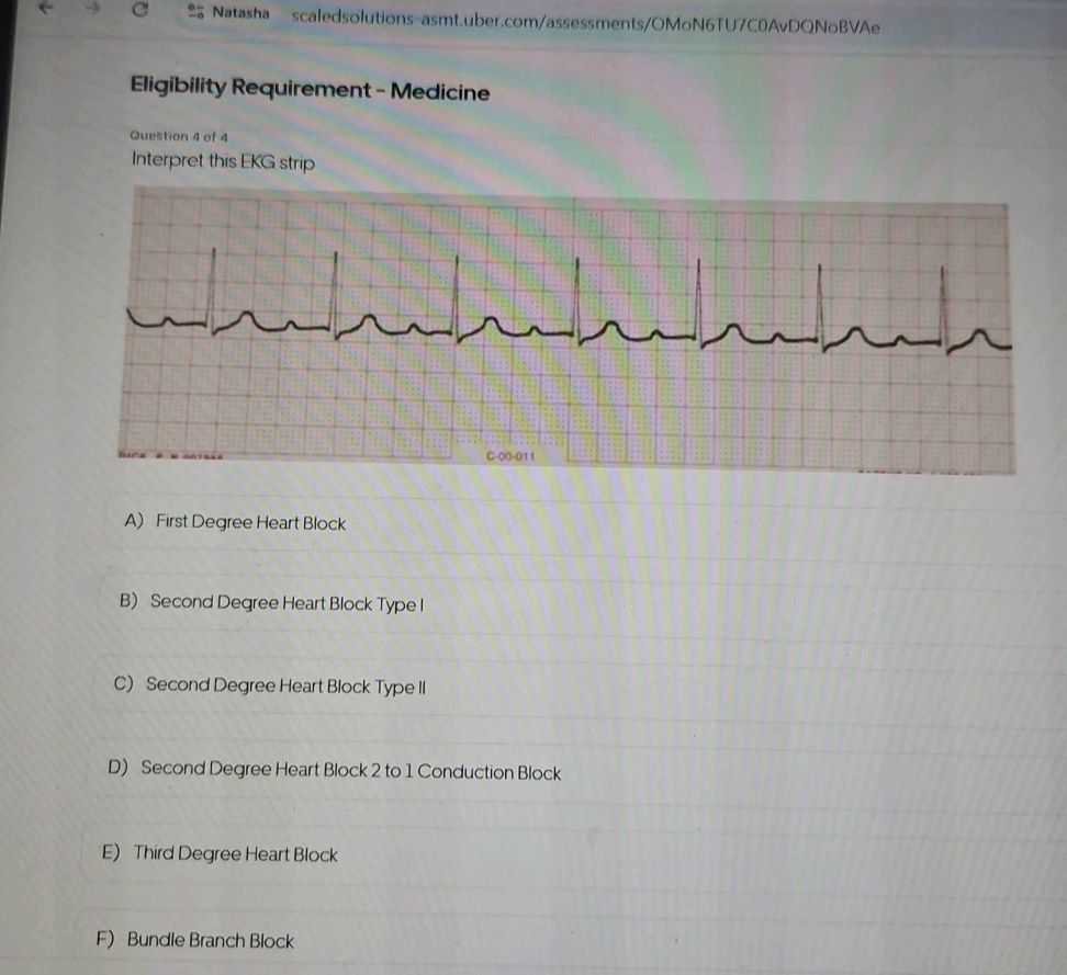 Interpret this EKG strip A) First Degree