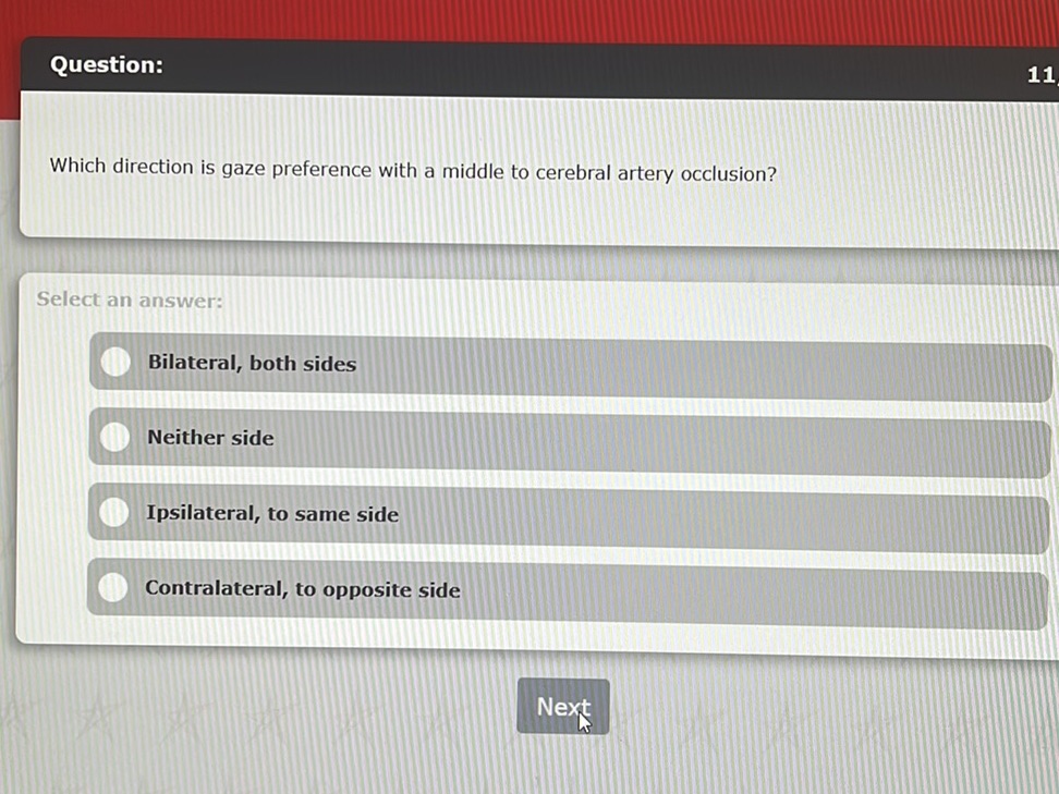Which direction is gaze preference with a | StudyX