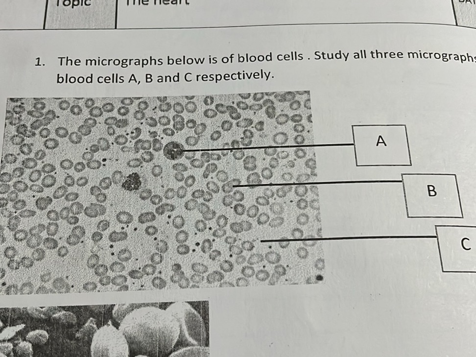 The micrographs below is of blood cells.