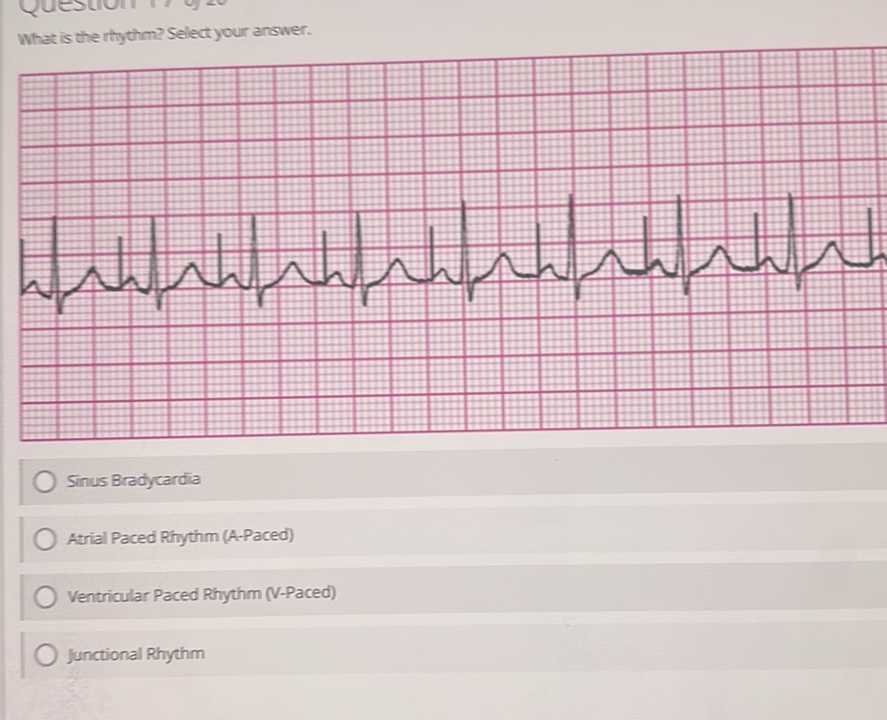 What is the rhythm? Select your answer. | StudyX