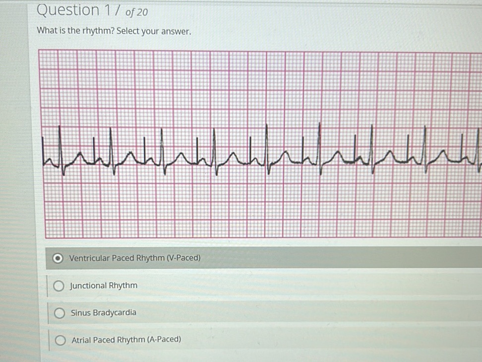 What is the rhythm? Select your answer. | StudyX