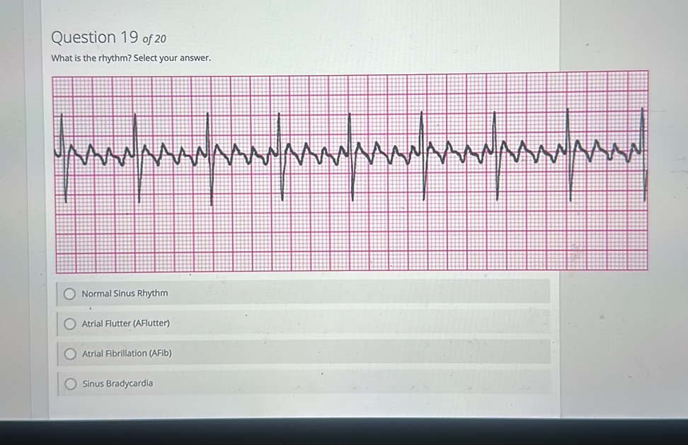 Question 19 of 20 What is the rhythm? Select | StudyX