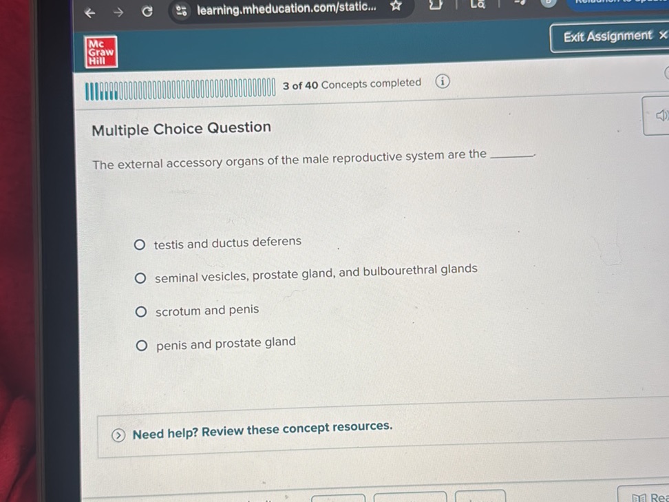 Multiple Choice Question The external | StudyX