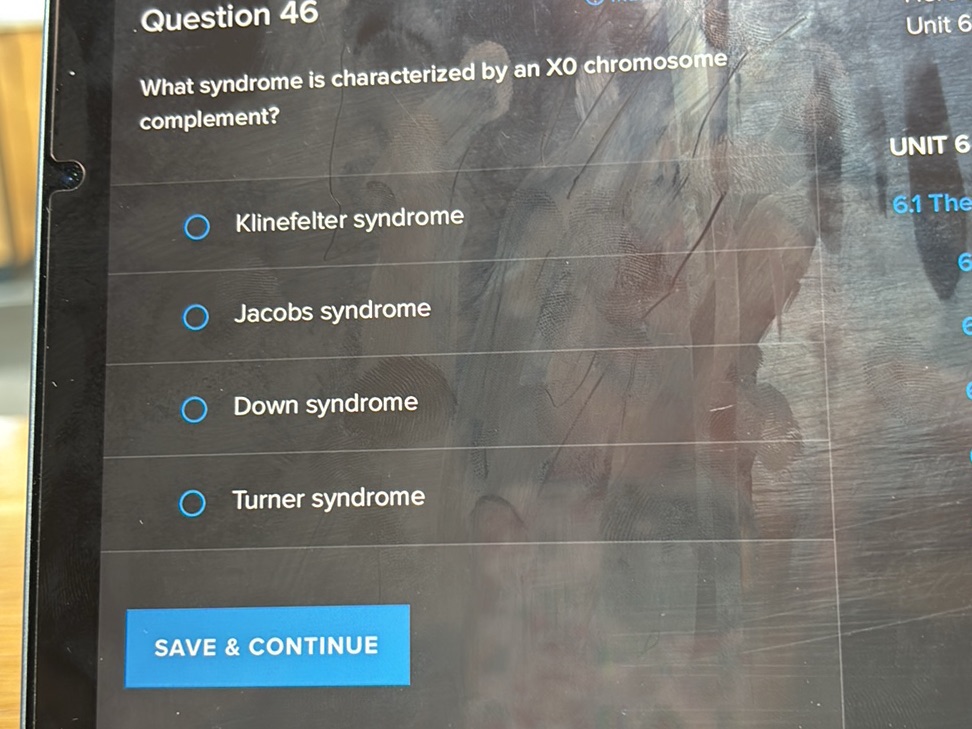 Question 46 What syndrome is characterized