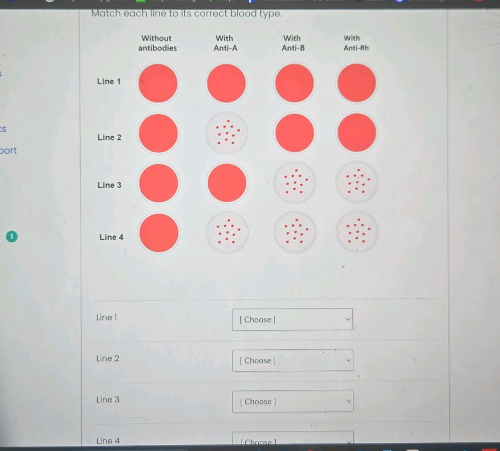 Match each line to its correct blood type. | StudyX