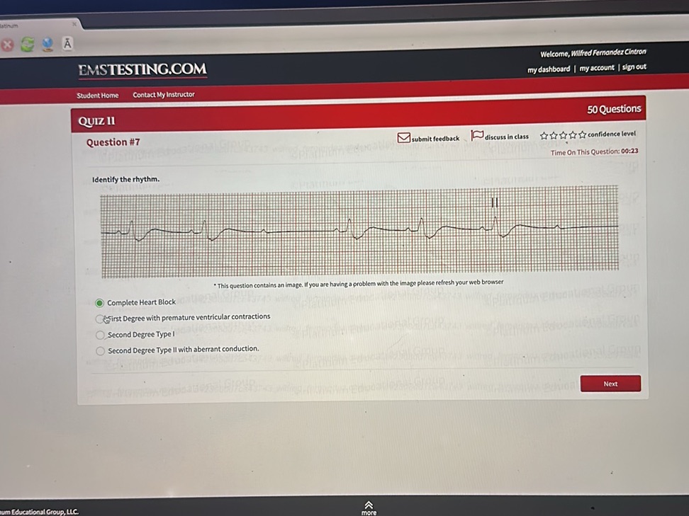 Identify the rhythm. Complete Heart Block | StudyX