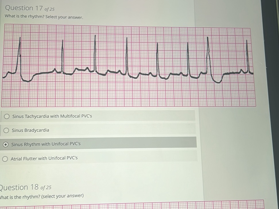 Question 17 of 25 What is the rhythm? Select | StudyX