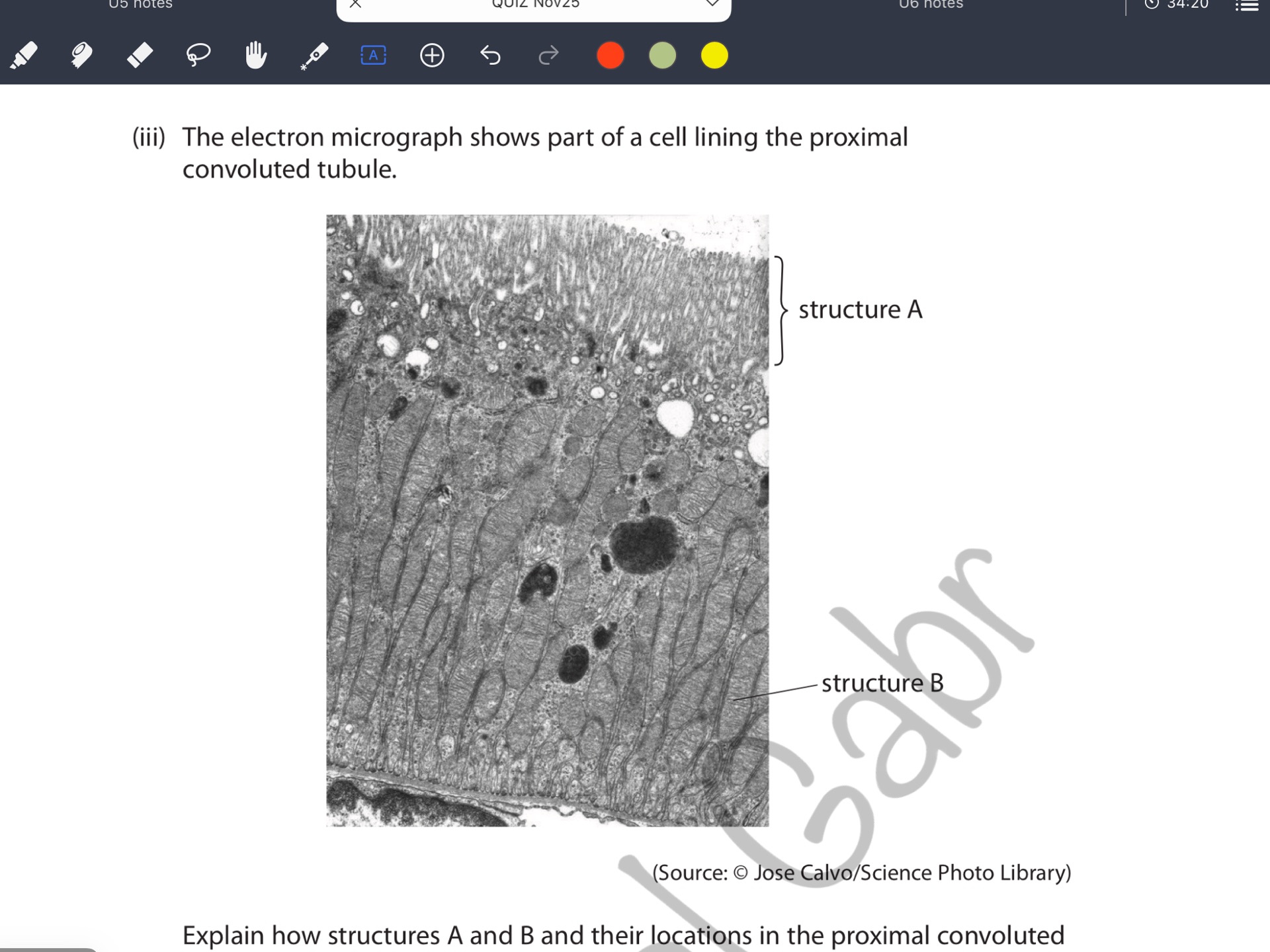 (iii) The electron micrograph shows part of | StudyX