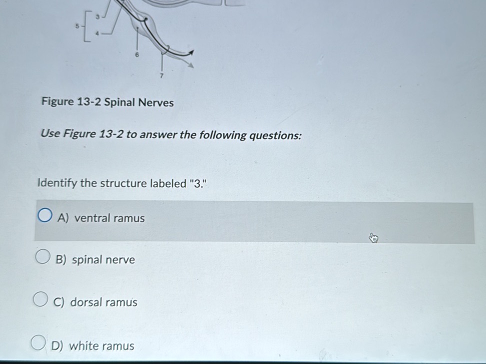 Identify the structure labeled "3." A) | StudyX