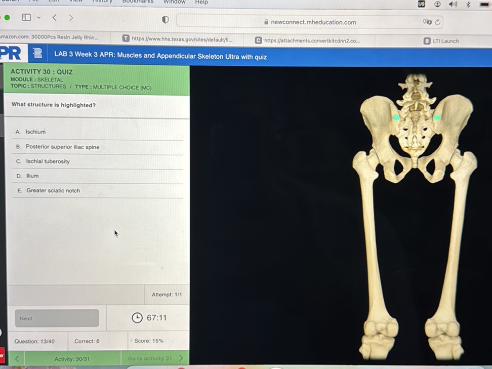 What structure is highlighted? A. Ischium | StudyX