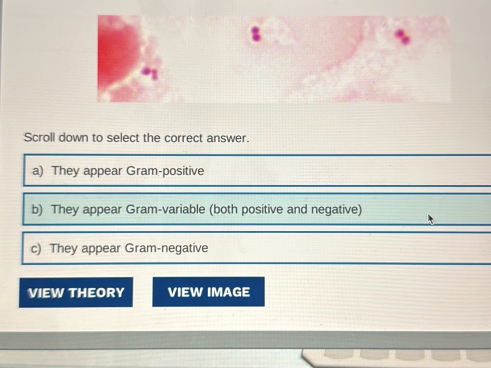 Scroll down to select the correct answer. | StudyX