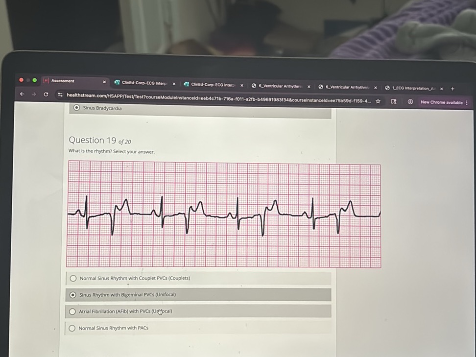 Question 19 of 20 What is the rhythm? Select | StudyX