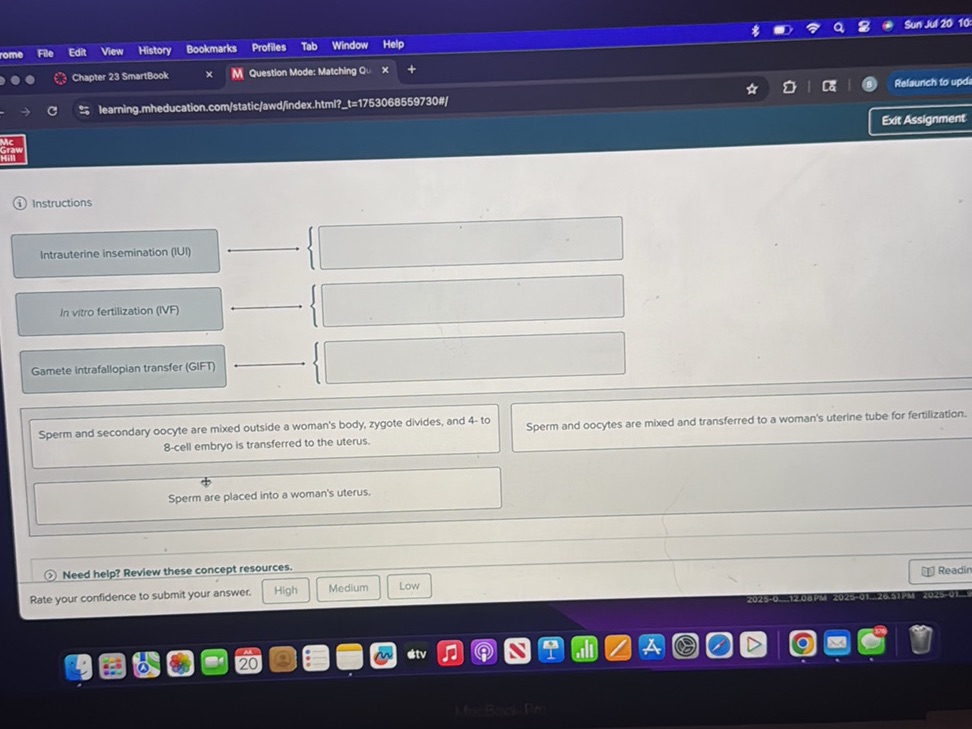 Match the following: Intrauterine | StudyX
