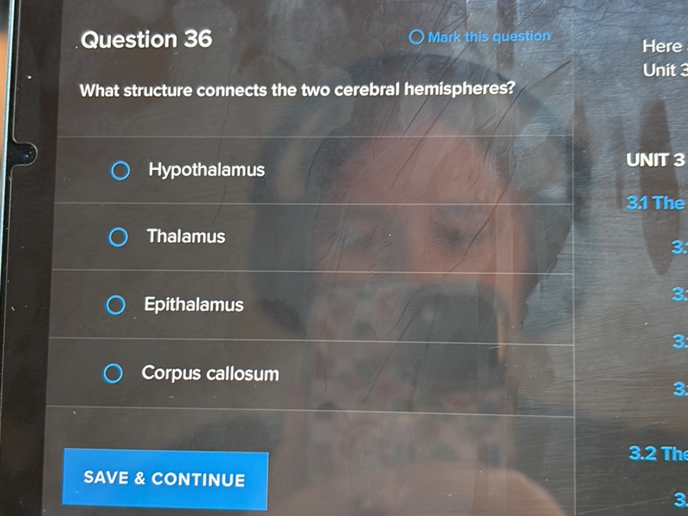 What structure connects the two cerebral | StudyX