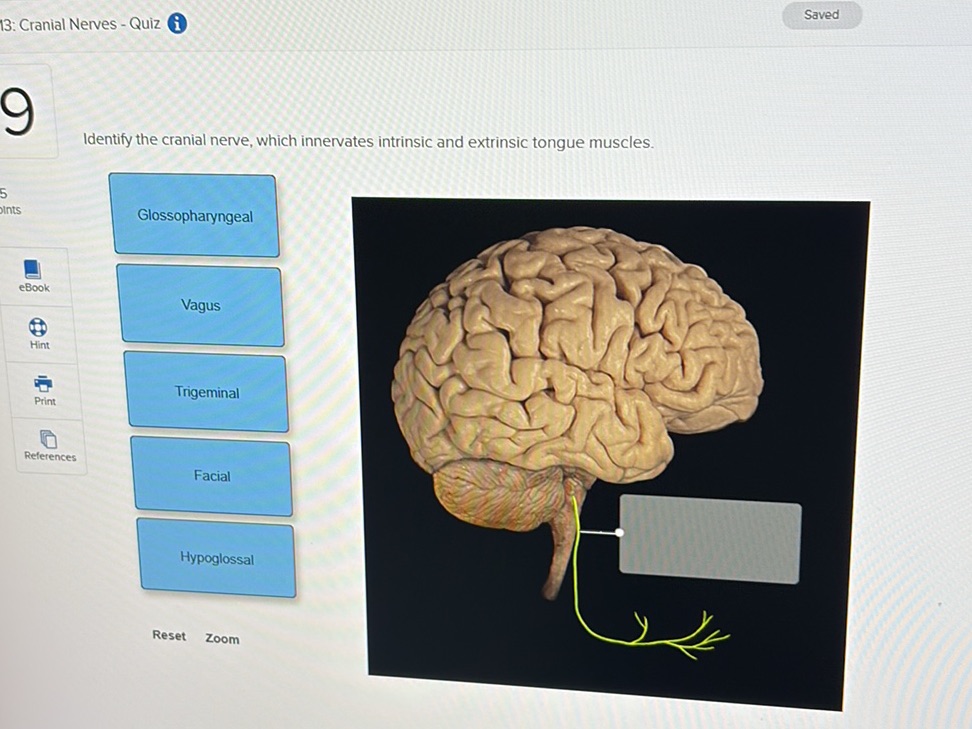 Identify the cranial nerve, which innervates | StudyX