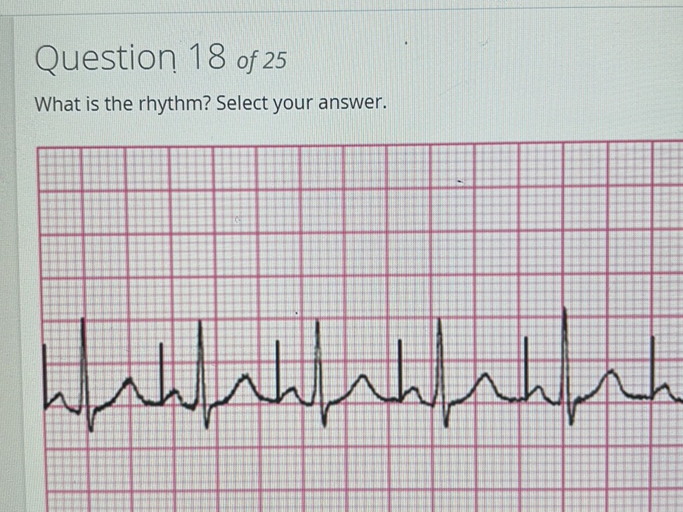 Question 18 of 25 What is the rhythm? Select