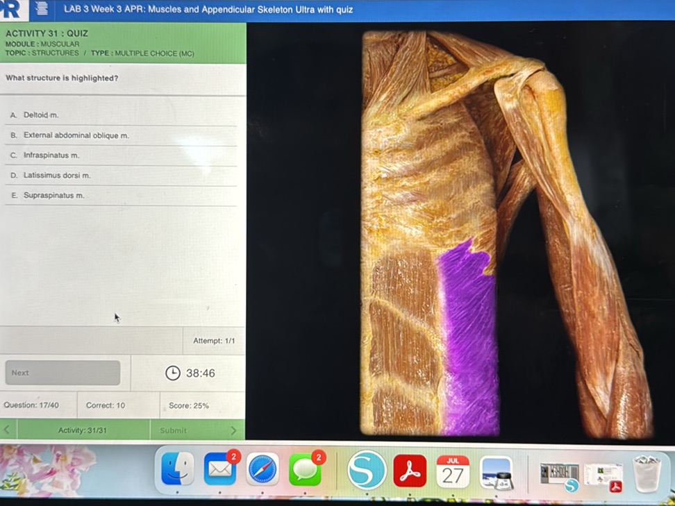 What structure is highlighted? A. Deltoid m.