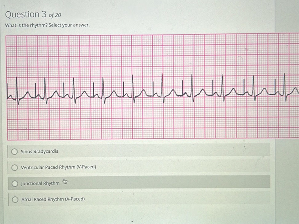 What is the rhythm? Select your answer.