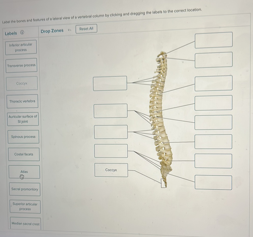 Label the bones and features of a lateral