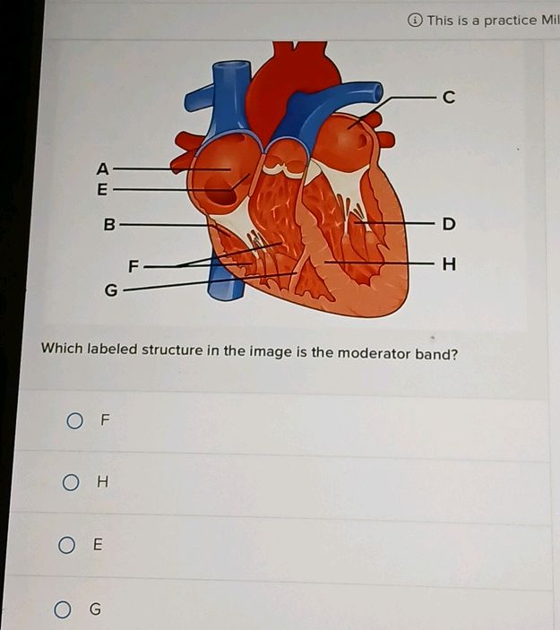 Which labeled structure in the image is the