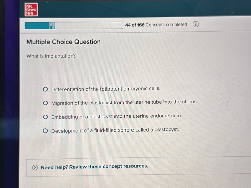 Multiple Choice Question What is | StudyX