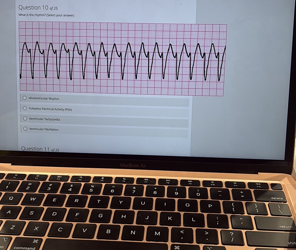 Question 10 of 25 What is the rhythm? | StudyX