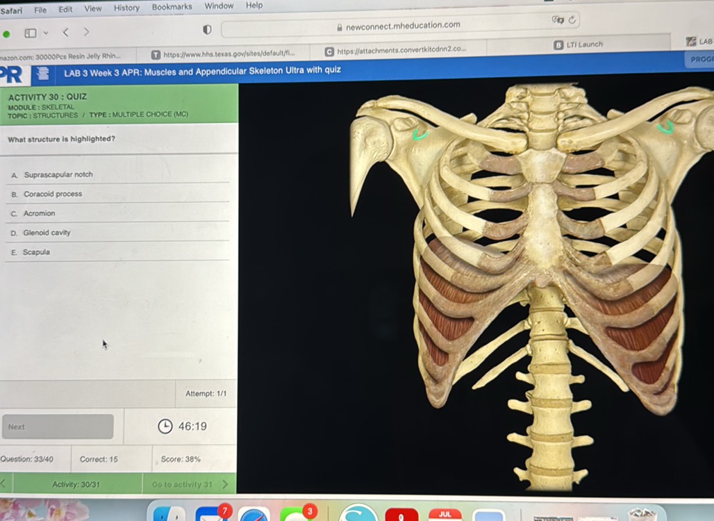 What structure is highlighted? A. | StudyX