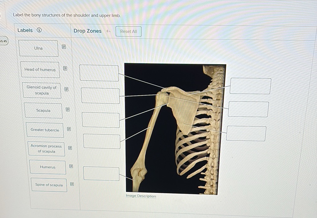 Label the bony structures of the shoulder