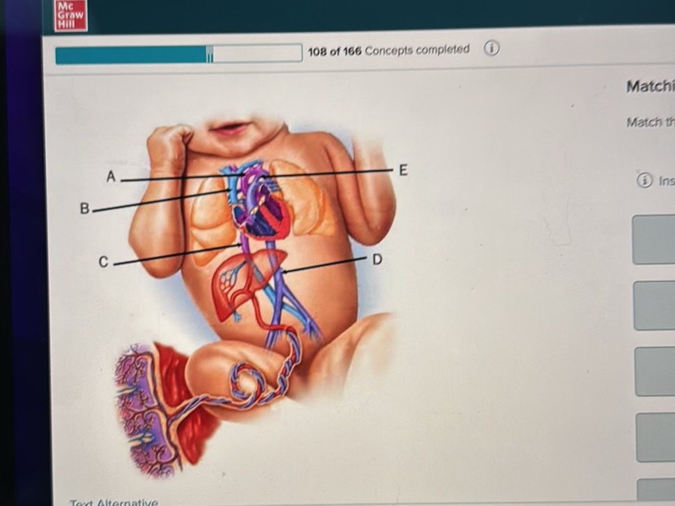 Matching question. Match the arrow with the | StudyX