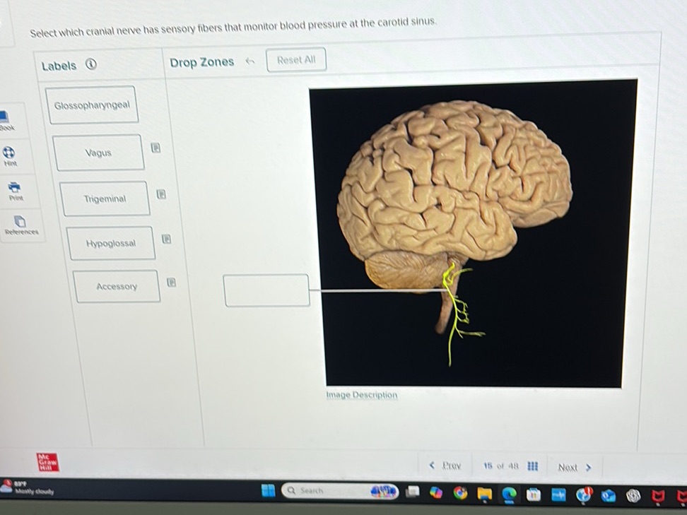 Select which cranial nerve has sensory | StudyX