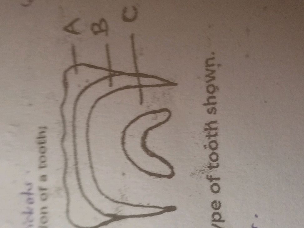 Identify the type of tooth shown in the