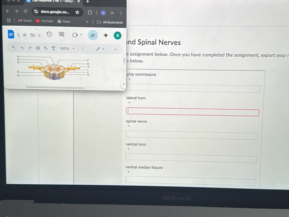gray commissure lateral horn spinal nerve | StudyX