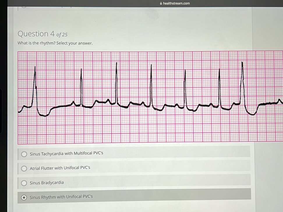 Question 4 of 25 What is the rhythm? Select | StudyX