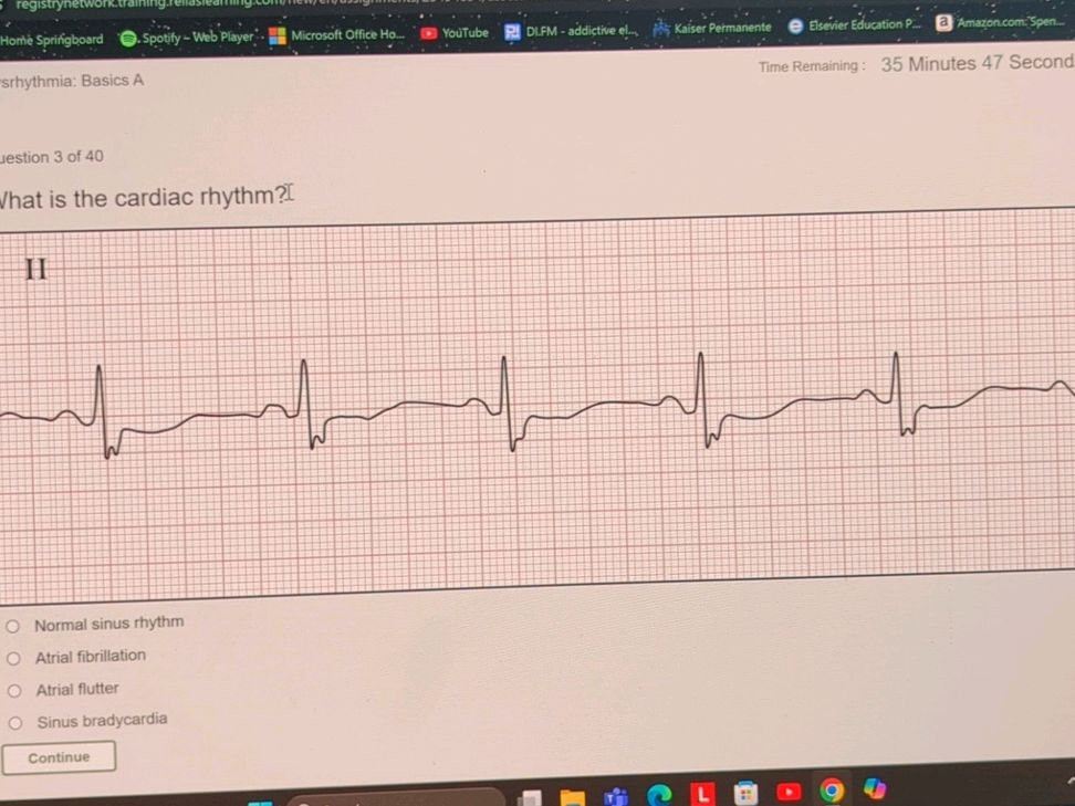 Question 3 of 40 What is the cardiac rhythm? | StudyX