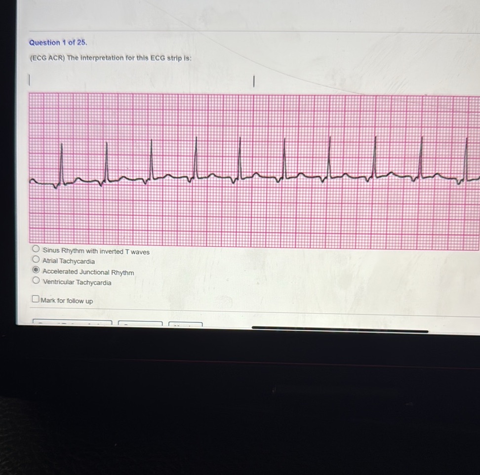 Question 1 of 25. (ECG ACR) The | StudyX