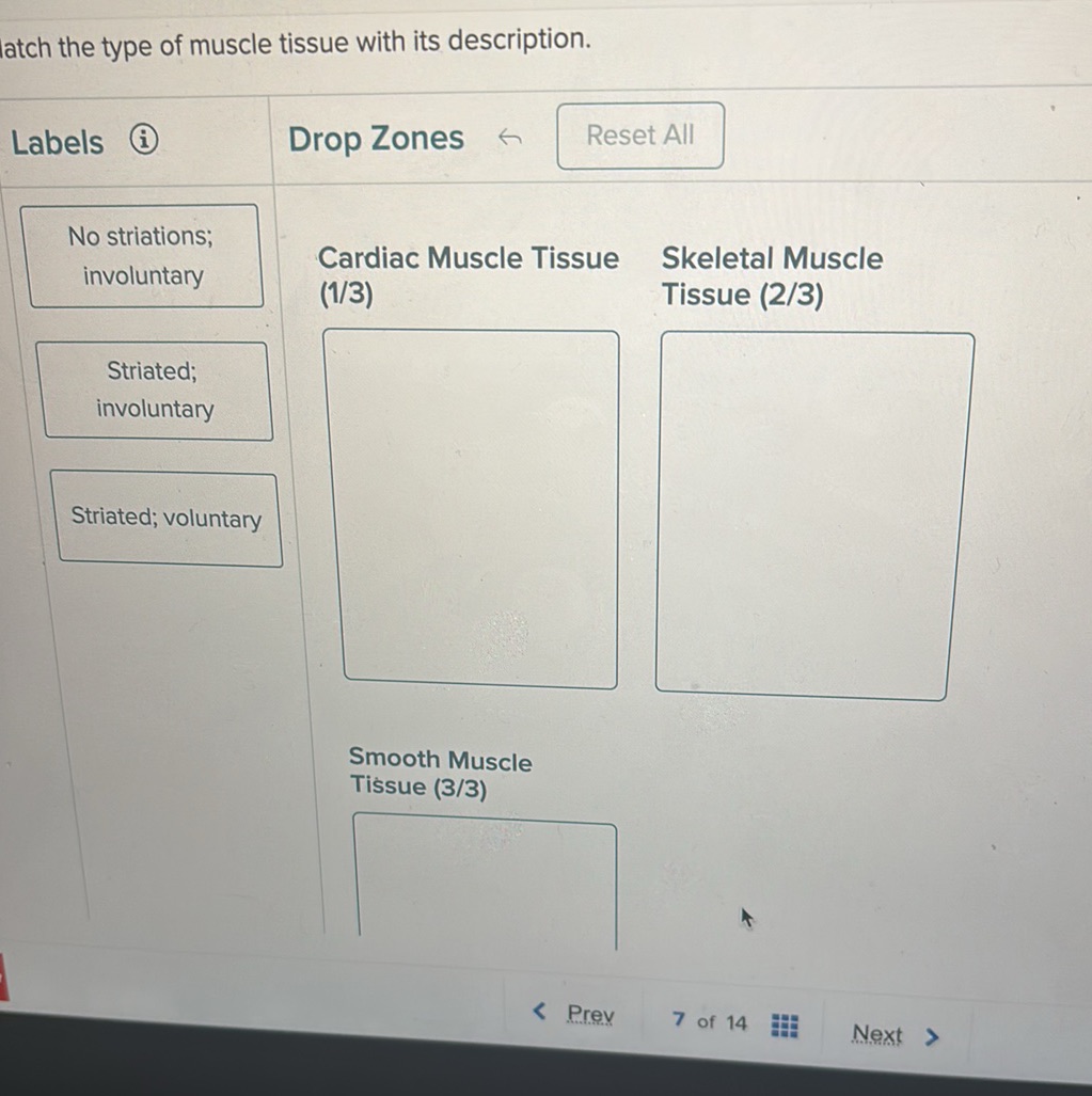 Match the type of muscle tissue with its | StudyX
