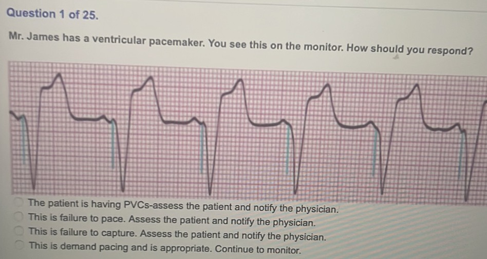 Mr. James has a ventricular pacemaker. You | StudyX