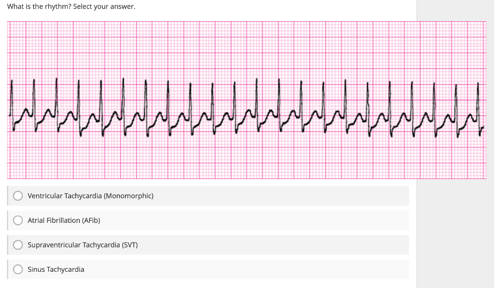 What is the rhythm? Select your answer. | StudyX