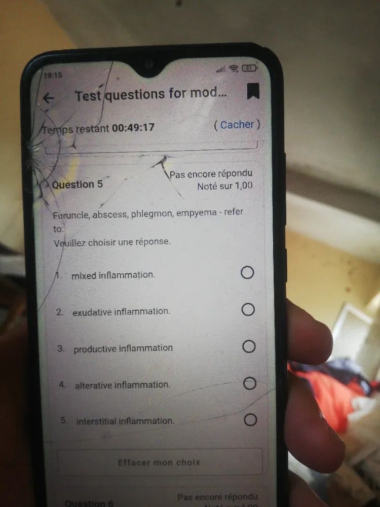 Furuncle, abscess, phlegmon, empyema - refer | StudyX