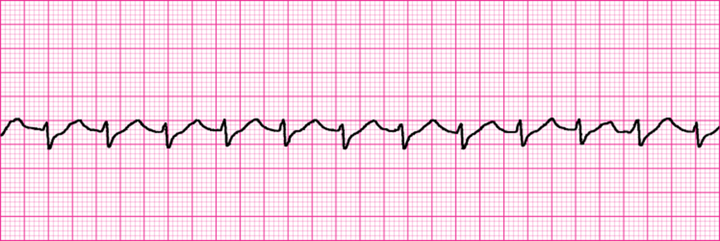 The image shows an ECG rhythm strip. | StudyX
