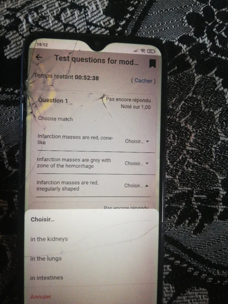 Choose match Infarction masses are red, | StudyX