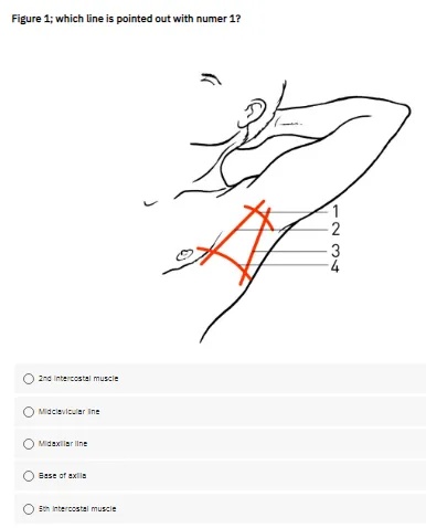 Figure 1 which line is pointed out with