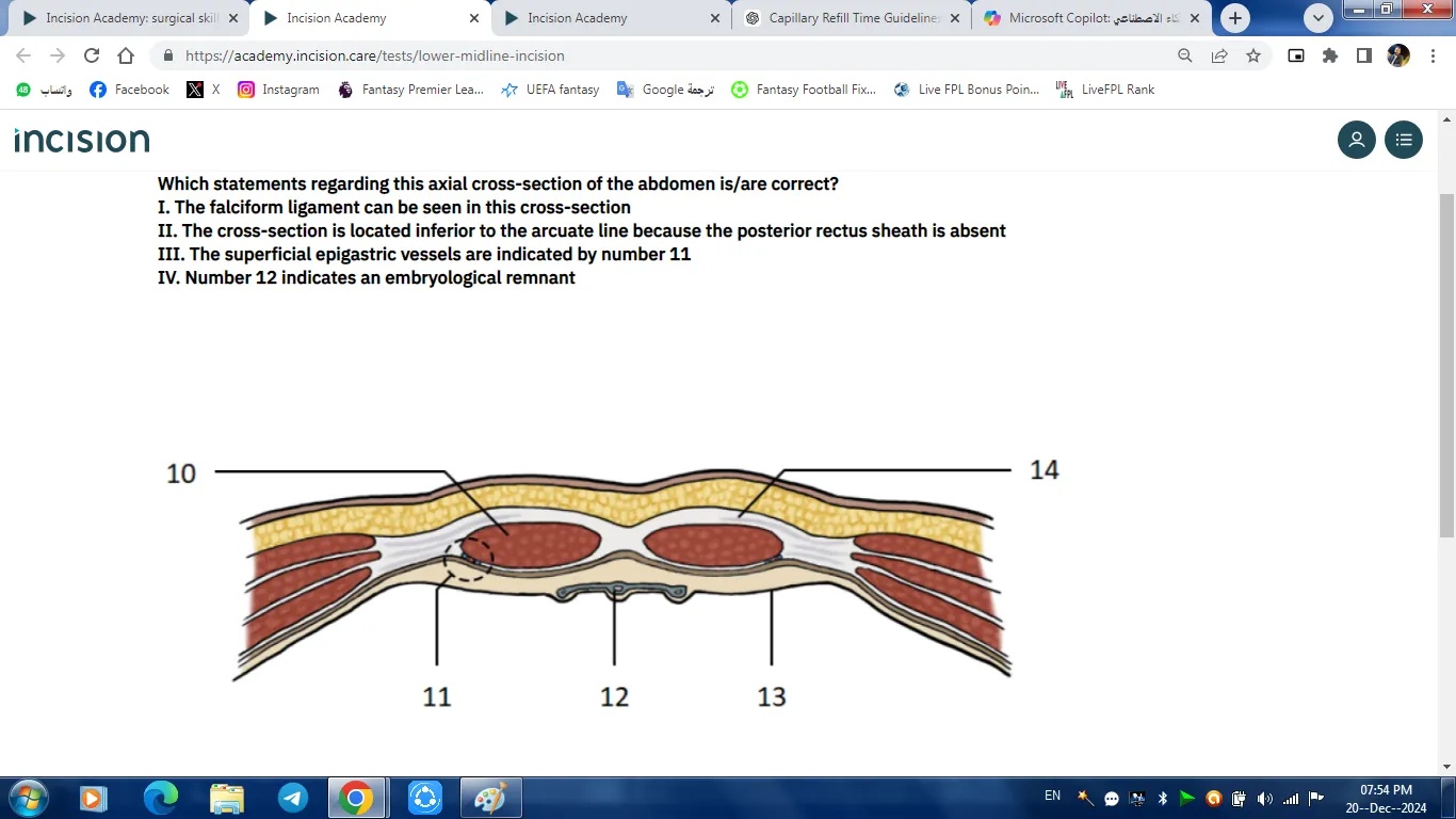 Which statements regarding this axial | StudyX